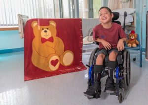 Acute Flaccid Myelitis (AFM): Sudden Limb Weakness in Children - Shifa ...